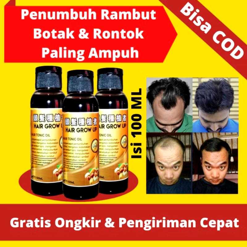 Jual HAIR GROW UP Obat Penumbuh Rambut Botak, Tipis dan Rontok Premium ...