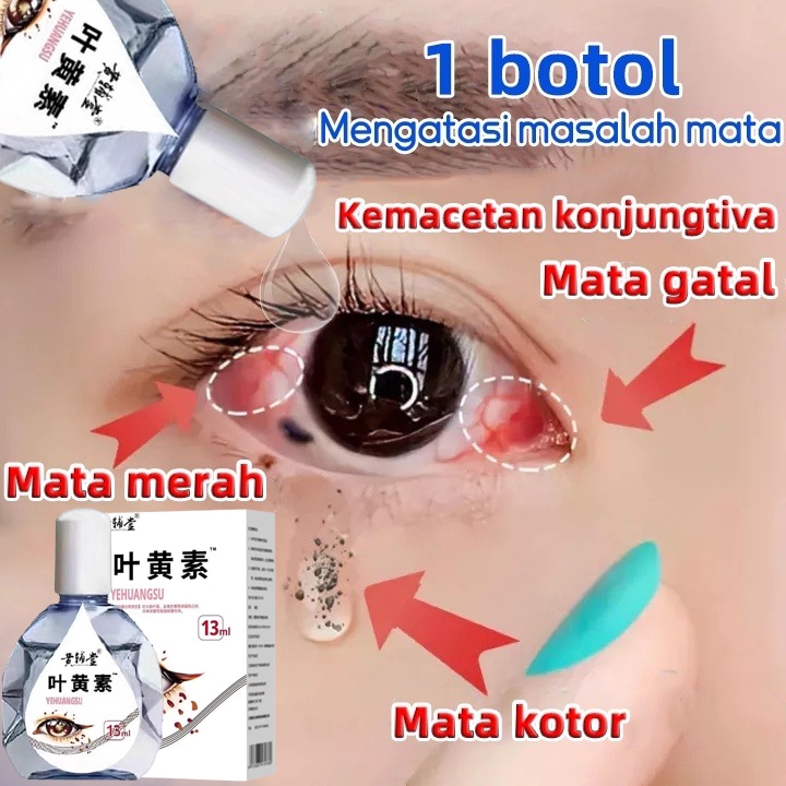 Jual Obat mata obat mata katarak obat tetes mata 13ml Mata kering Sakit ...