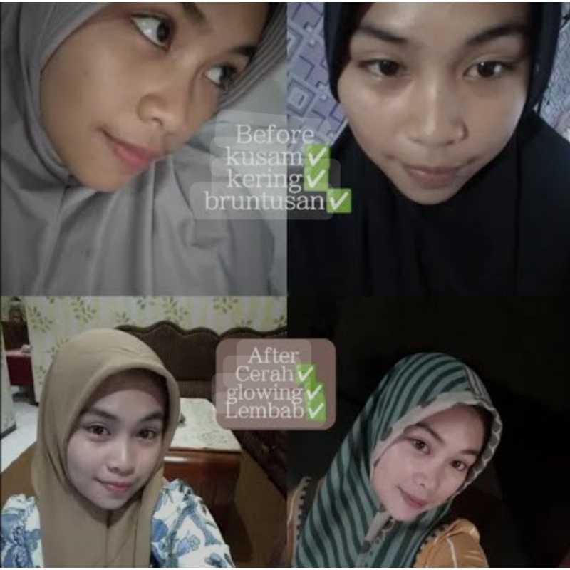 Jual INVANIL Minuman Invanil Collagen Berkualitas Terbaik Ampuh Lulus ...