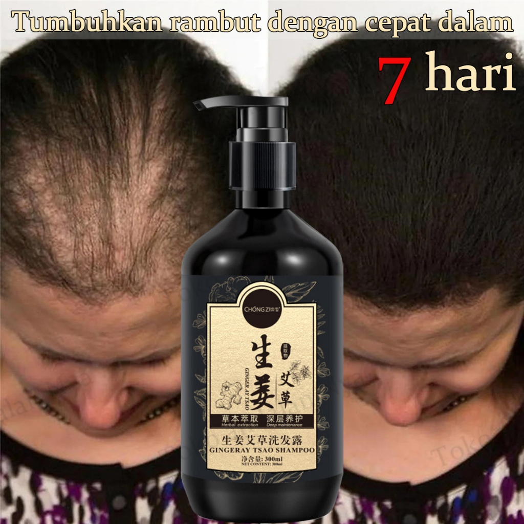 Jual sampo anti ketombe dan rontok ginger shampo penumbuh rambut shampo penumbuh rambut cepat ...