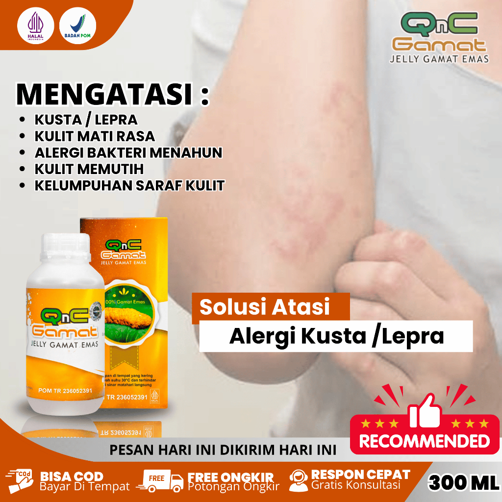 Jual Obat Lepra Kusta Kering Basah Penyakit Kulit Menahun Menular ...