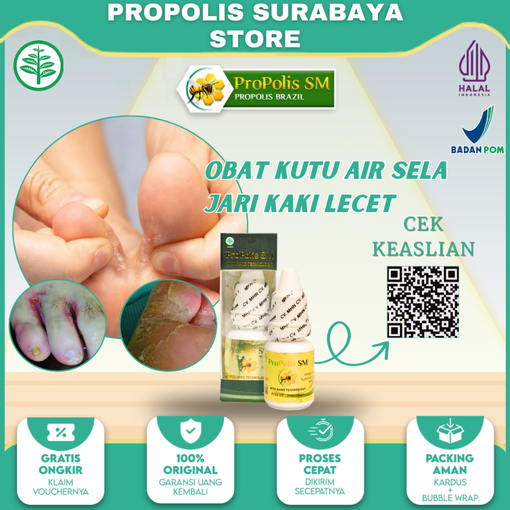 Jual Obat Kutu Air Untuk Kaki Gatal Dan Perih Pada Sela Jari kaki Kutu ...