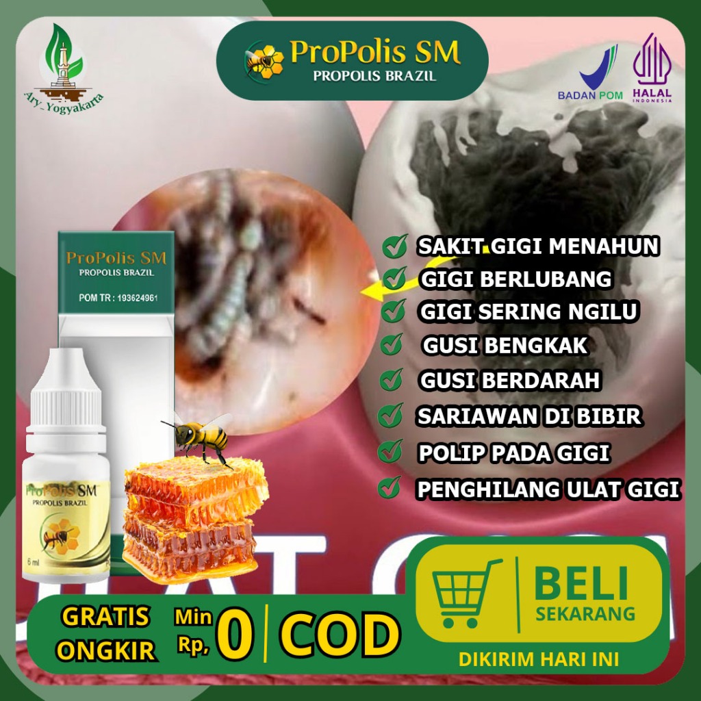 Jual Cara Menghilangkan Ulat Pada Gigi - Ulat Gigi Manusia - Ulat Gigi ...