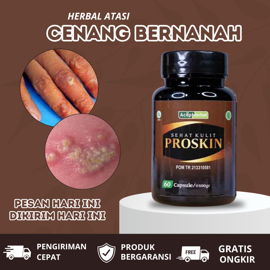 Jual Proskin- Obat gatal bernanah, cenang budug untuk seluruh badan ...
