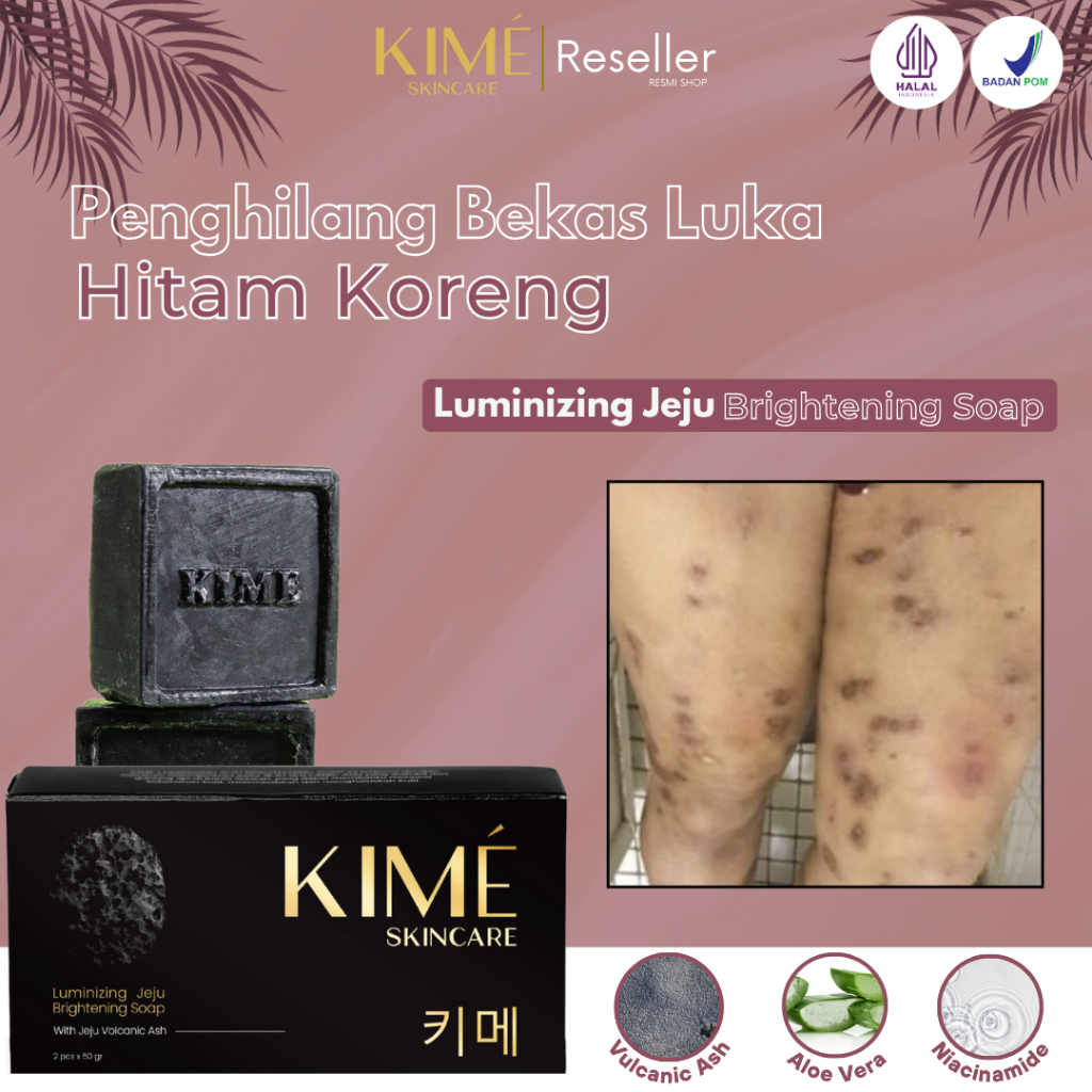 Jual KIME BRIGHTENING SOAP ORIGINAL 100% TRUSTED penghilang bekas luka ...