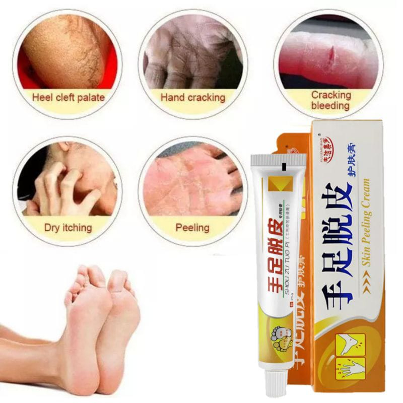 Jual ( PROMO ) Salep SKIN PEELING CREAM Perawatan kulit, penghalus ...