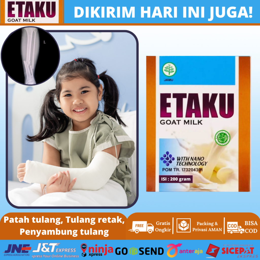 Jual Susu etaku untuk patah tulang - obat patah tulang dan retak ...