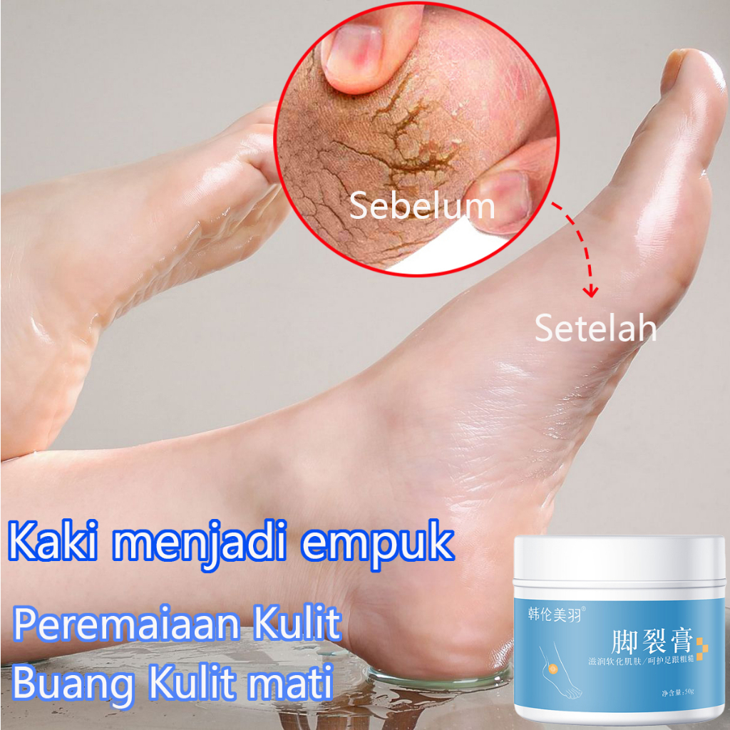 Jual Foot Cream Obat Kaki Pecah Dan Kering 50g OBAT KAKI PECAH DAN ...