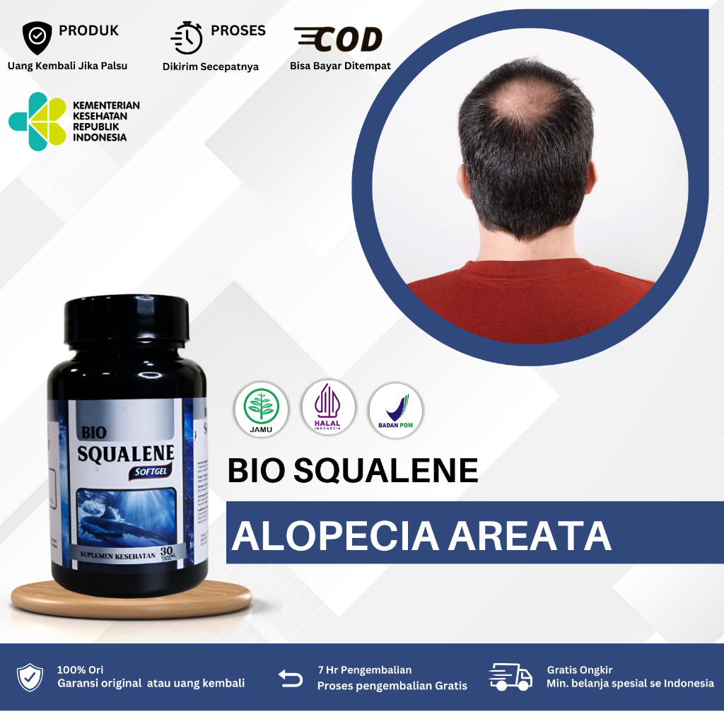 Jual Obat Alopecia Areata kebotakan Rambut Pada Kepala, Bio Squalene ...