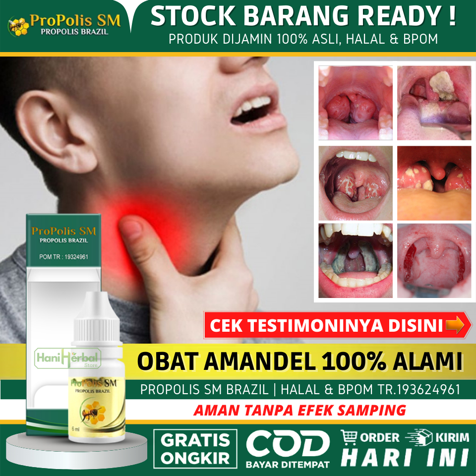 Jual OBAT AMANDEL HERBAL UNTUK ANAK & DEWASA - RADANG TENGGOROKAN ...