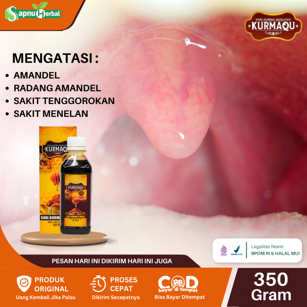 Jual Obat Amandel, Amandel Anak Dan Dewasa, Herbal Tonsil Akut Dan ...