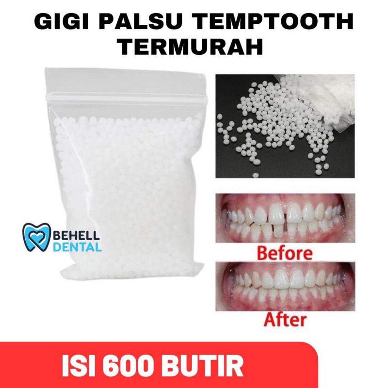 Jual GIGI PALSU SEMENTARA 600 BUTIR / PENAMBAL GIGI PATAH RENGGANG ...