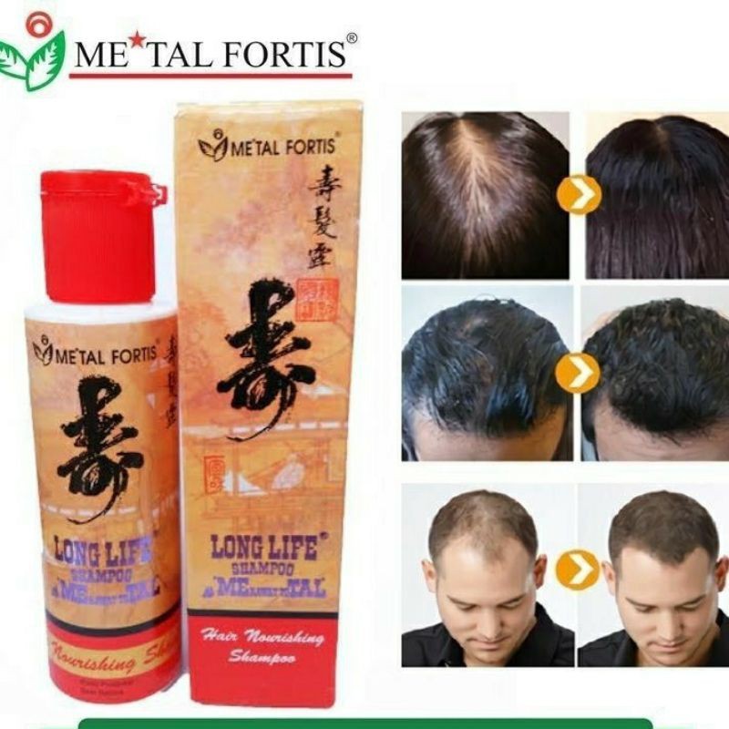 Jual Shampo Metal Fortis 60ml Sampo Penumbuh Rambut Cepat Panjang ...
