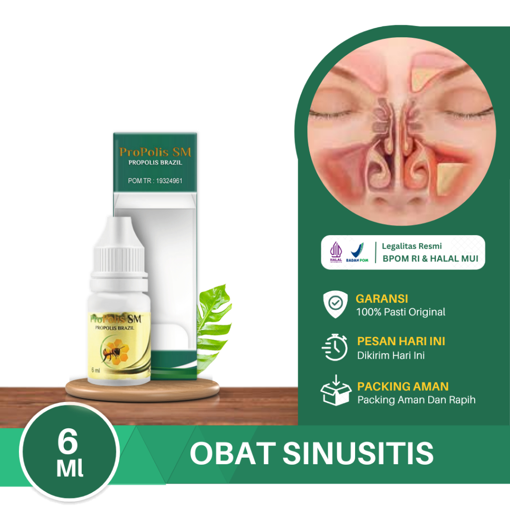 Jual Obat Sinusitis, Sinusitis Akut, Peradangan di Rongga Sinus ...
