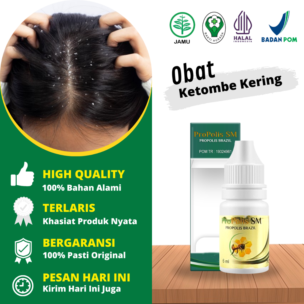 Jual Obat Ketombe Kering, Ketombe Berkerak - Ketombe Akut - Ketombe Parah Rambut Rontok, Obat ...
