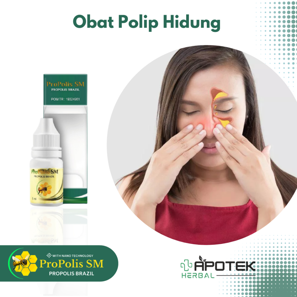 Jual Obat Polip Hidung Sinusitis Obat Benjolan di dalam Hidung Hidung ...