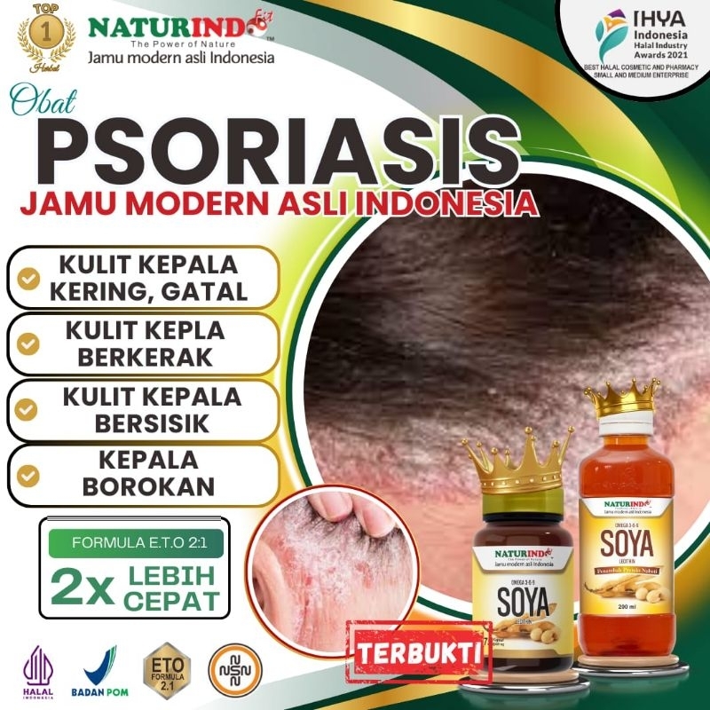 Jual 𝗣𝗦𝗢𝗥𝗜𝗔𝗦𝗜𝗦 Obat Psoriasis Kulit Bersisik Berkerak Ketombe [HERBAL ...