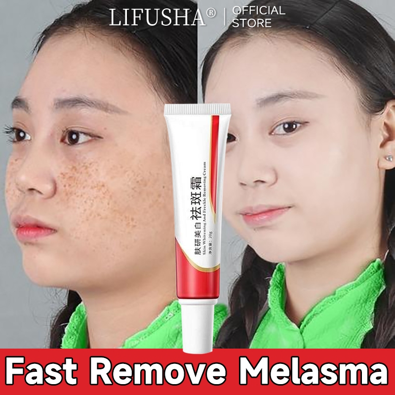 Jual 【祛斑保湿】100% Effective and Original Whitening Freckle Cream Remover ...