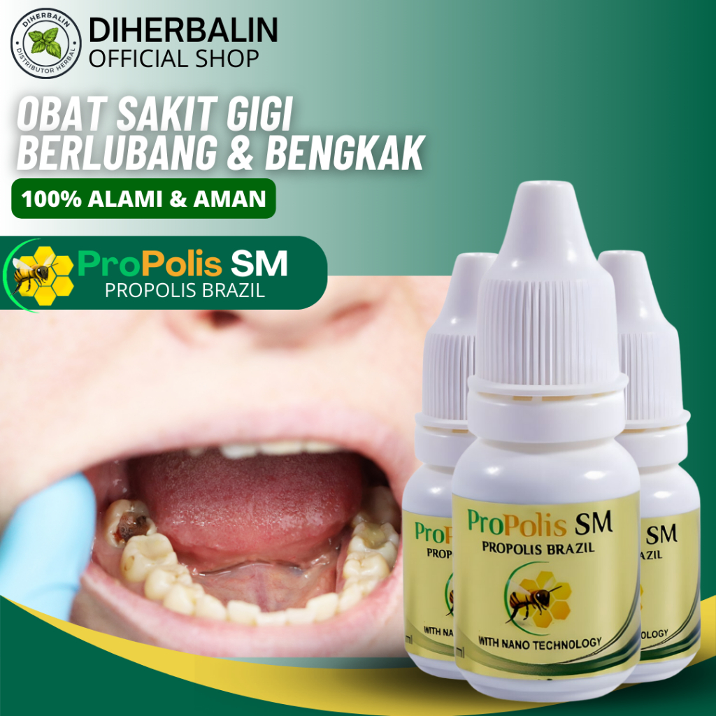 Jual Obat Sakit Gigi Gusi Bengkak Gusi Berdarah Gigi Berlubang Abses ...