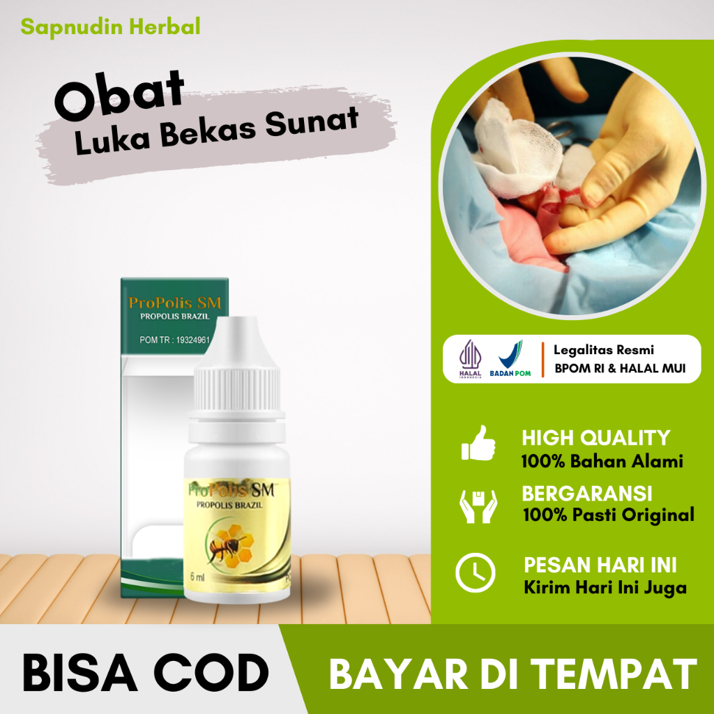 Jual Obat Salep Pengering Luka Sunat Luka Khitan Penghilang Luka Bekas ...