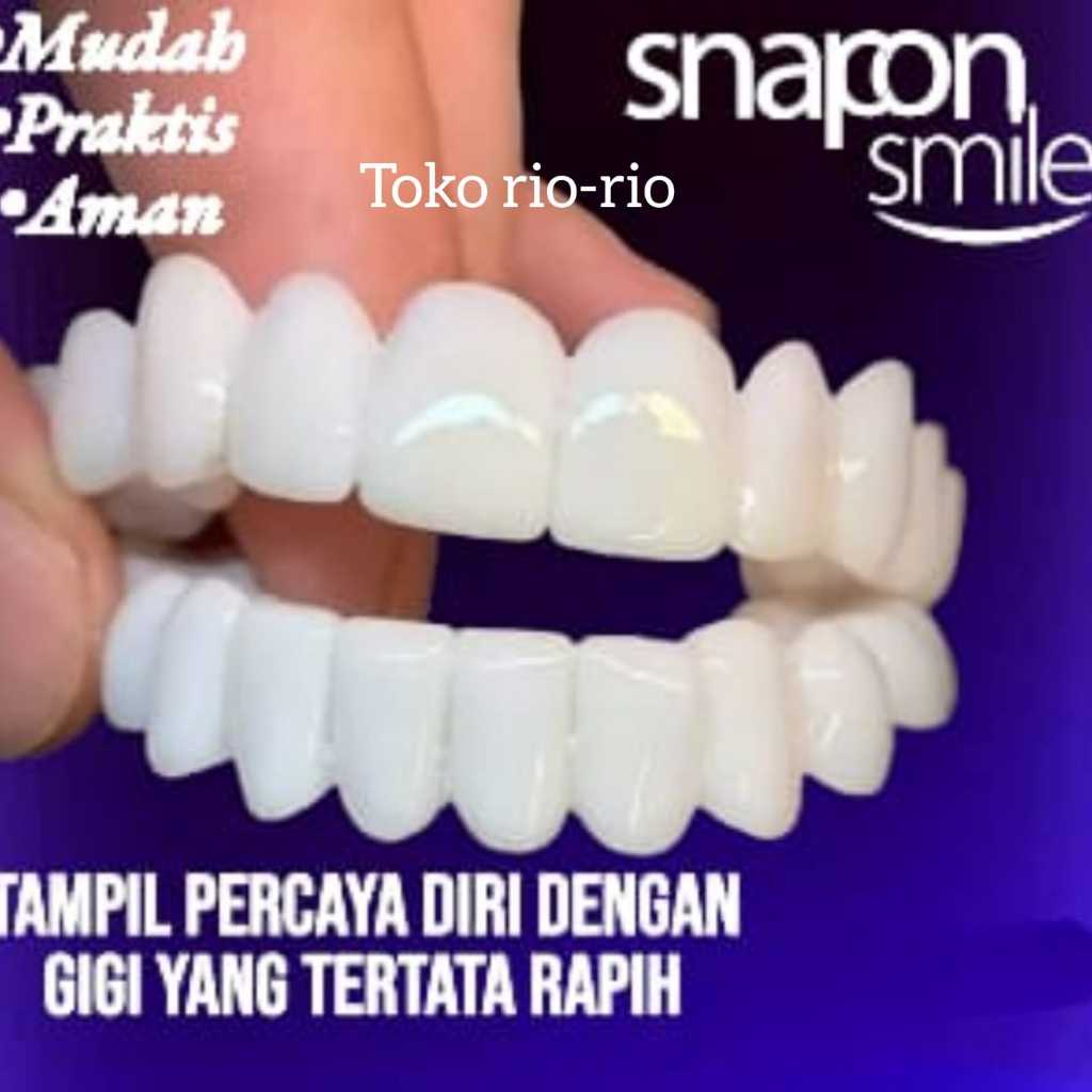 Jual Snap On Smile Venner Gigi Palsu 1 SET (ATAS & BAWAH) Gigi Palsu ...