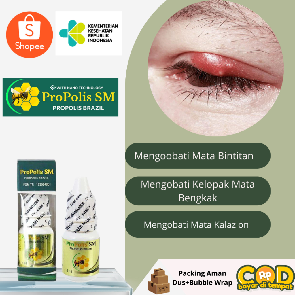 Jual Obat Oles Bengkak Gatal Pengempis Mata Bintitan ,| Mata Kalazion ...