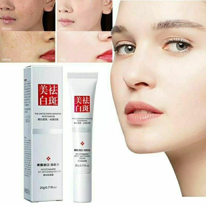 Jual SK Whitening Freckle Cream Remove Dark Spot Anti Freckle Cream Niaciamide Fade Pigmentation ...