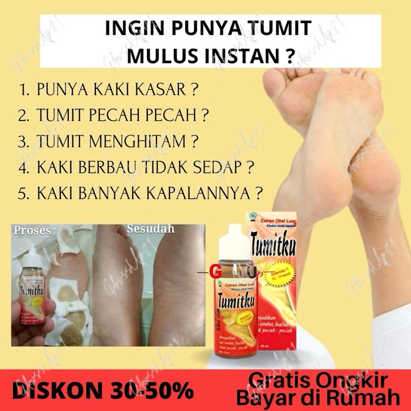 Jual TUMITKU MENGATASI KAKI PECAH KAPALAN DENGAN CEPAT CAIRAN OBAT LUAR ...