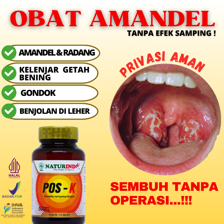 Jual Obat Amandel Obat Benjolan Di Leher Obat Radang Tenggorokan Dewasa ...