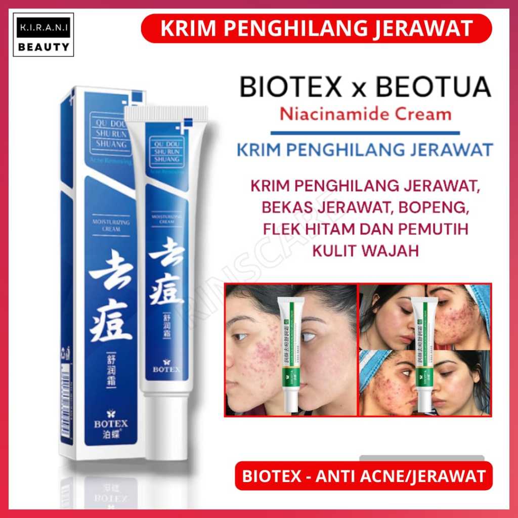 Jual [ BIOTEX x BEOTUA ] Krim Pelembut dan Pelembab Wajah Acne Removing ...