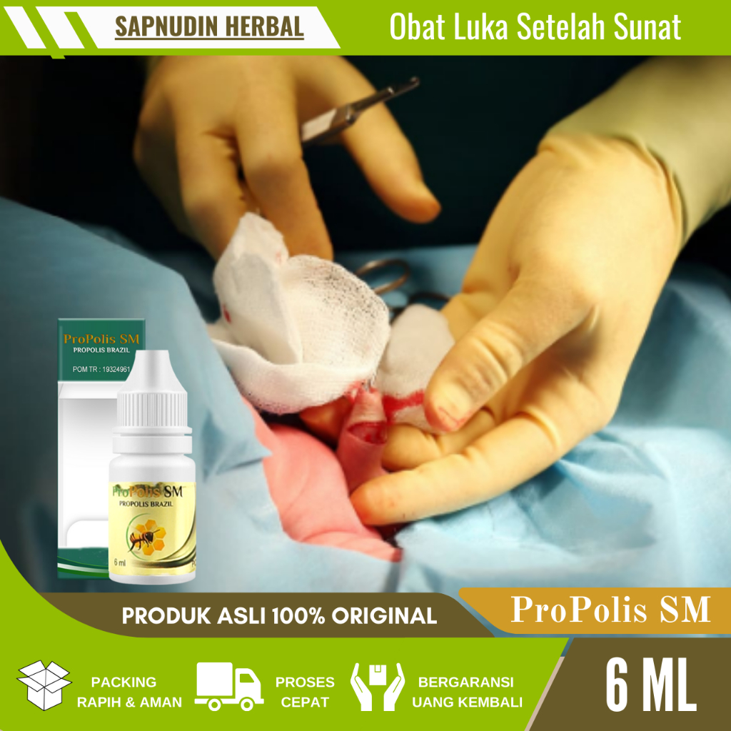 Jual Obat Luka Setelah Sunat, Obat Luka Sehabis Sunat, Obat untuk Luka ...