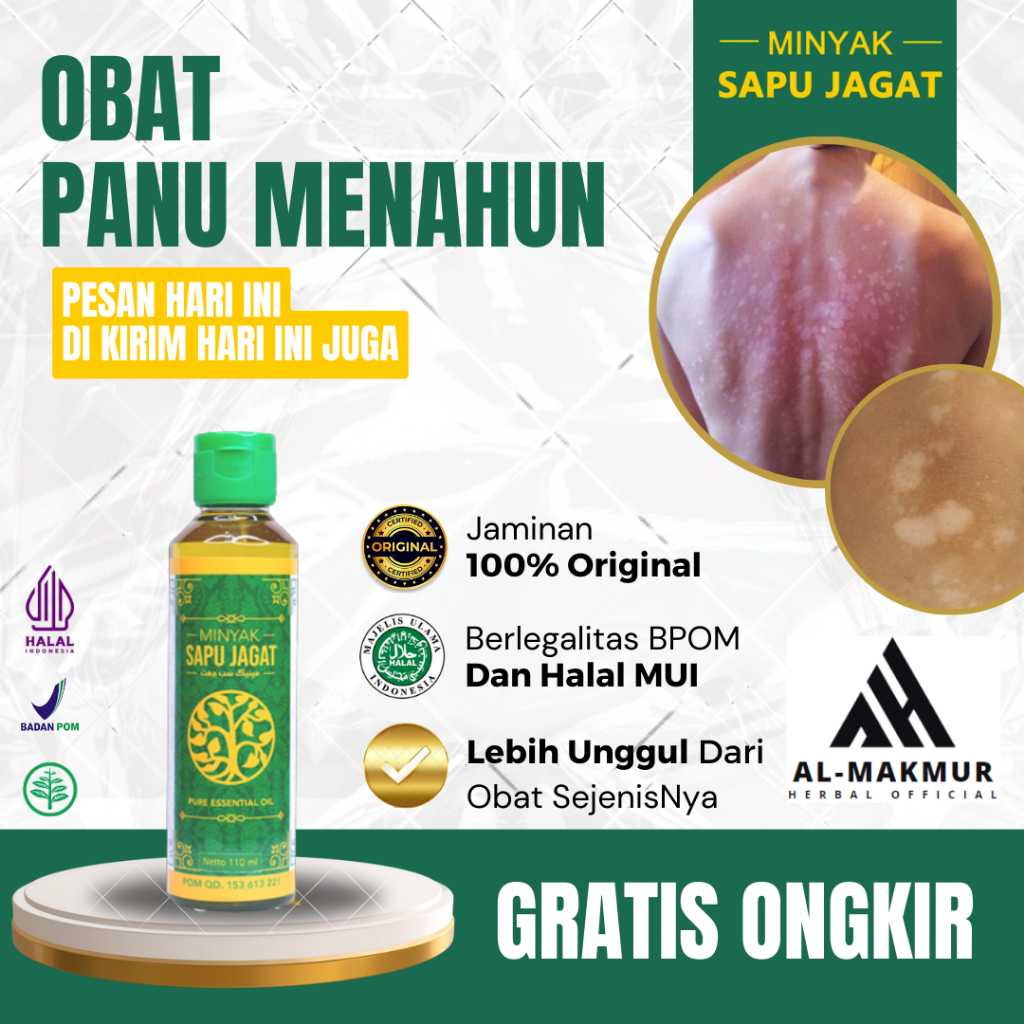 Jual Obat Panu Menahun, Obat Hapur di Wajah, Obat Jamur Kulit Panu ...