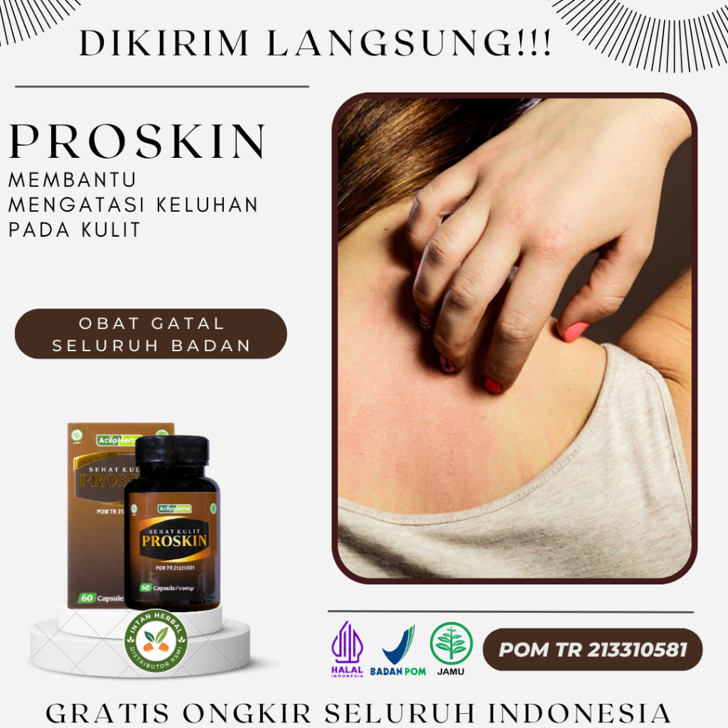 Jual Proskin 100% Original - Obat Gatal Seluruh Badan, Kulit Gatal ...