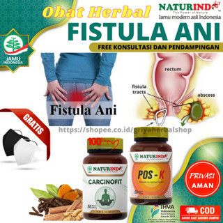 Jual Obat Fistula Ani Bisul di Pantat Obat Bisul Bernanah Benjolan ...