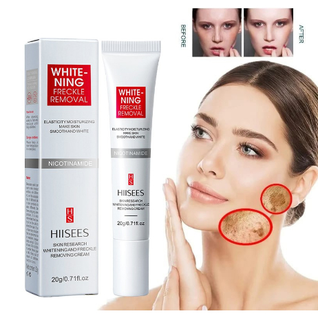 Jual cream pemutih Hiisees Cream Penghilang Flek Hitam Dan Melasma ...