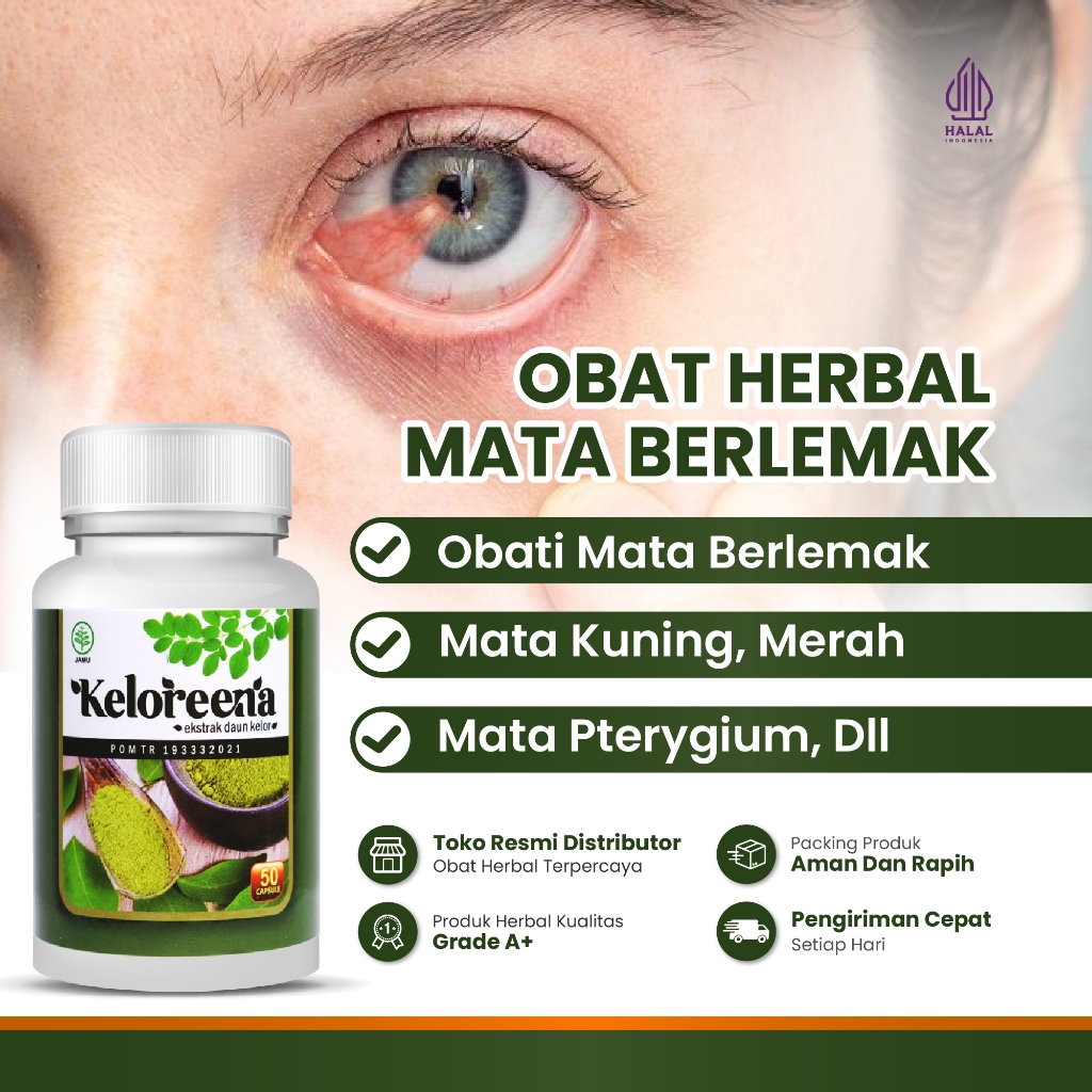 Jual Obat Mata Berlemak Kekuningan Pterygium Mata Merah Penghilang Lamad Di Mata Glaukoma ...