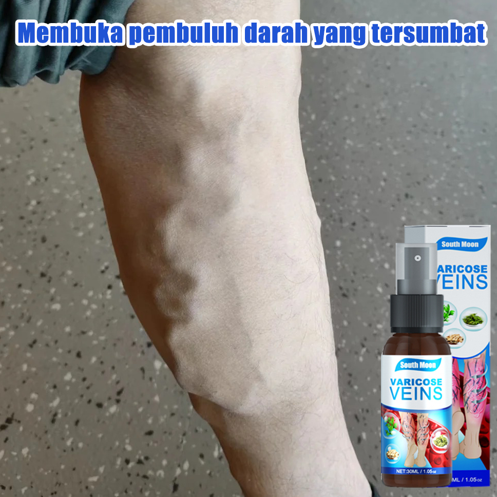 Jual Varicose Veins Spray Obat Varises Salep ampuh salep varises ...