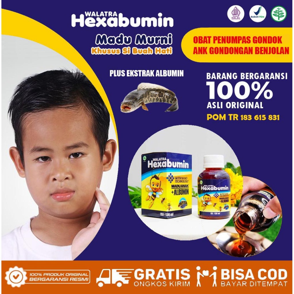 Jual Obat Gondok Beracun Anak, Obat Gondongan Anak, Obat Kelenjar ...