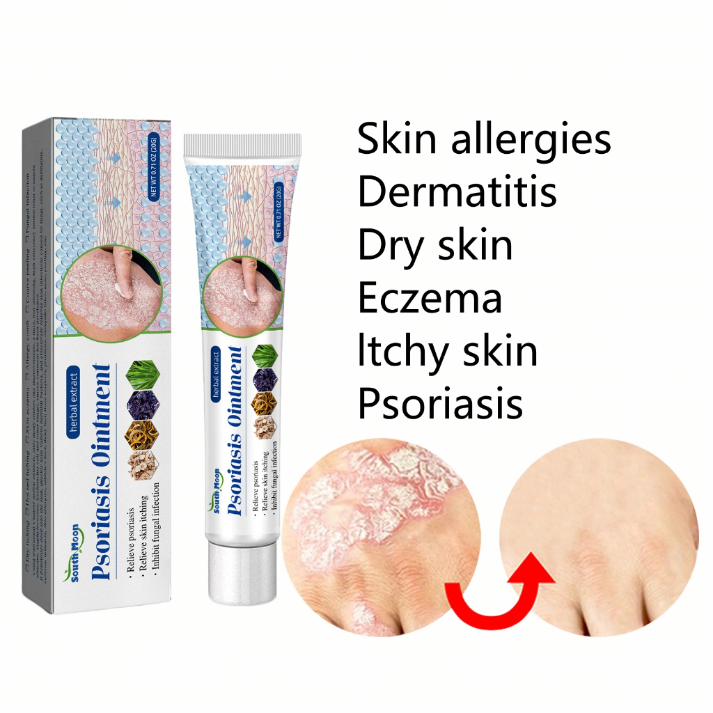 Jual Psoriasis ointment Obat oles infeksi kulit Obat gatal Salep ...