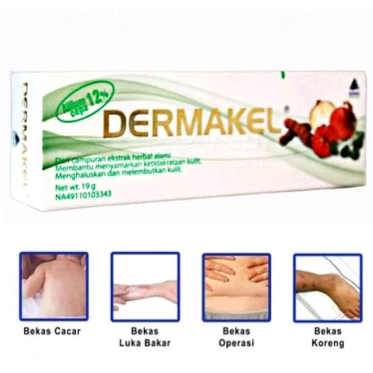 Jual Dermakel Gel 19 gram Penghilang Bekas Luka/keloid/Scar Bopeng ...