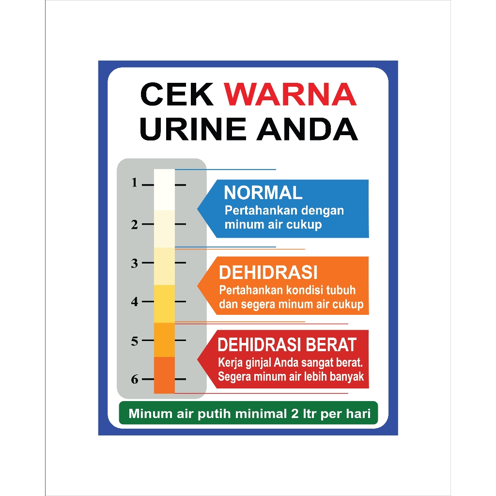Jual STIKER VINYL CEK WARNA URINE ANDA Uk. 20 x 25 CM SIGN RAMBU K3 ...