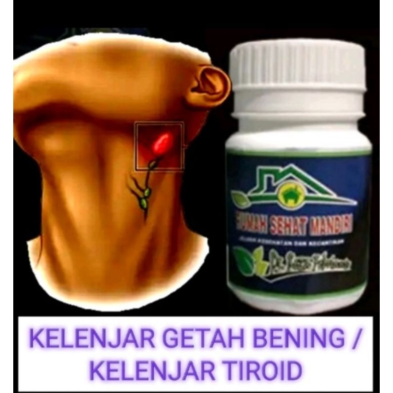 Jual Obat Hipertiroid Tiroid Membengkak Kelenjar Tiroid, Gondok ...