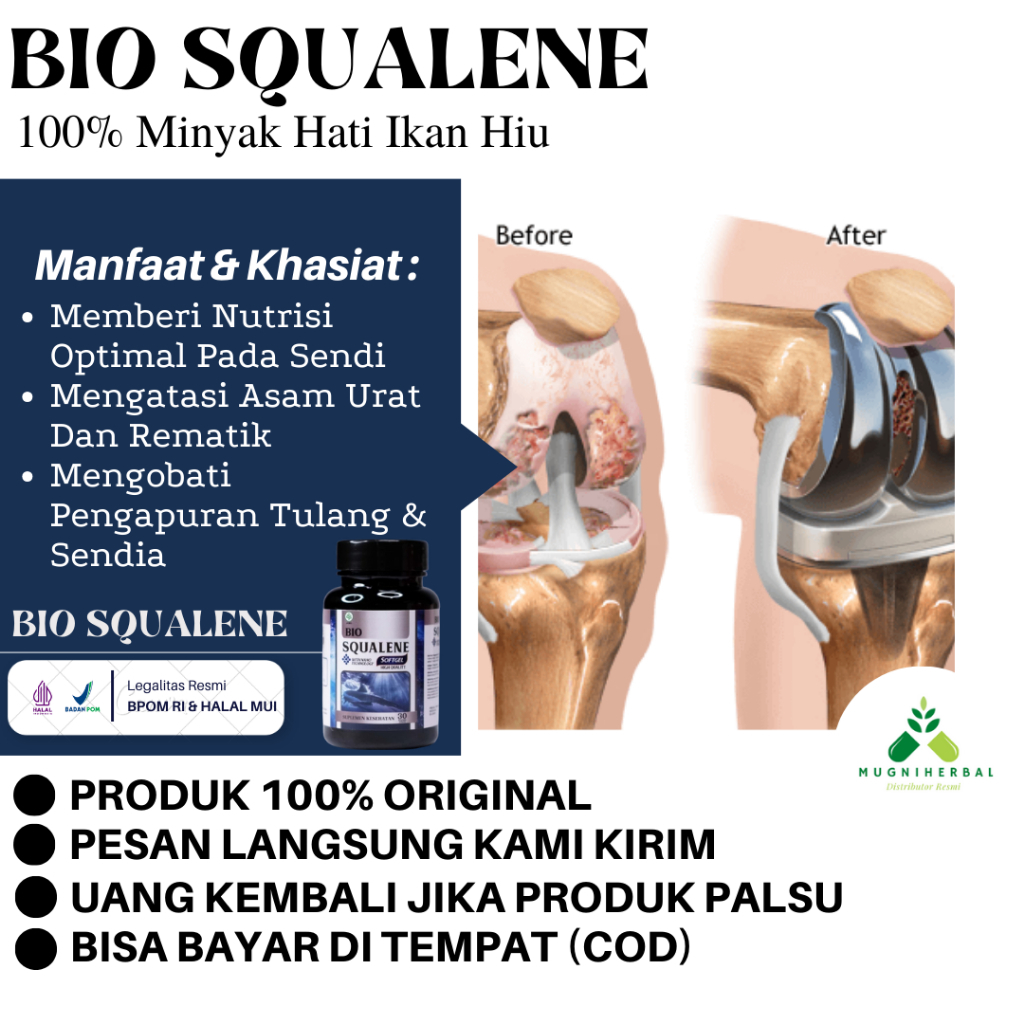 Jual Obat Pelumas Tulang Dan Sendi, Cedera Tulang Rawan Sendi, Sakit ...