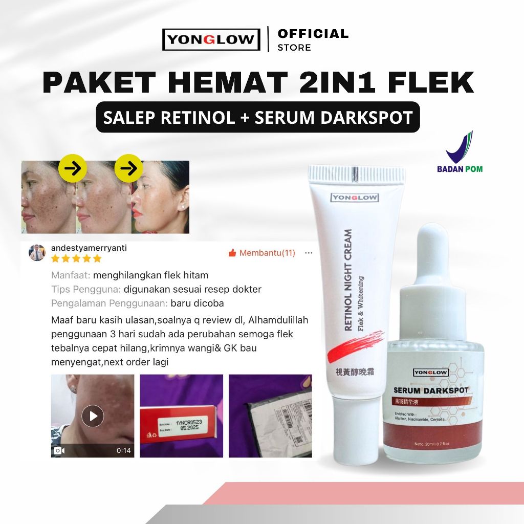 Jual Yonglow Paket 2in1 Flek Hitam Membandel BPOM Serum Darkspot Salep Retinol Penghilang Flek ...