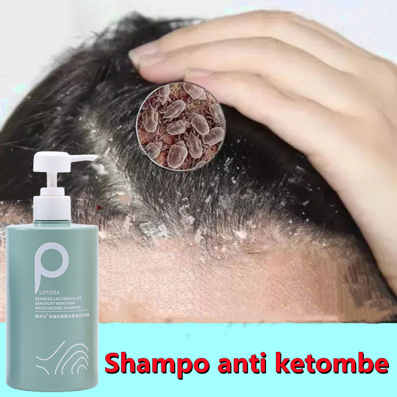 Jual Shampo buat ketombe Shampoo penghilang ketombe anti gatal pengobatan ketombe penghilang ...