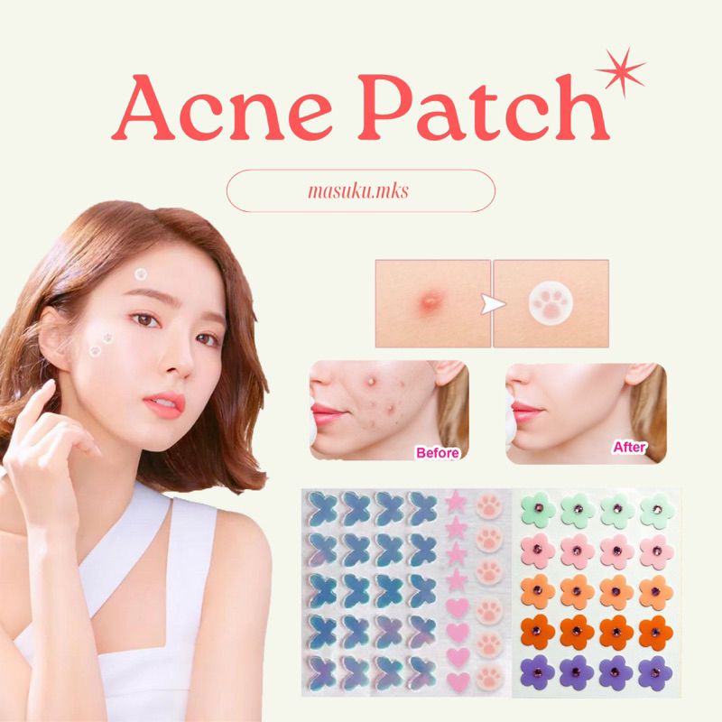 Jual Acne Patch / Patch Jerawat / Cute Acne Patch / Acne Patch Lucu ...