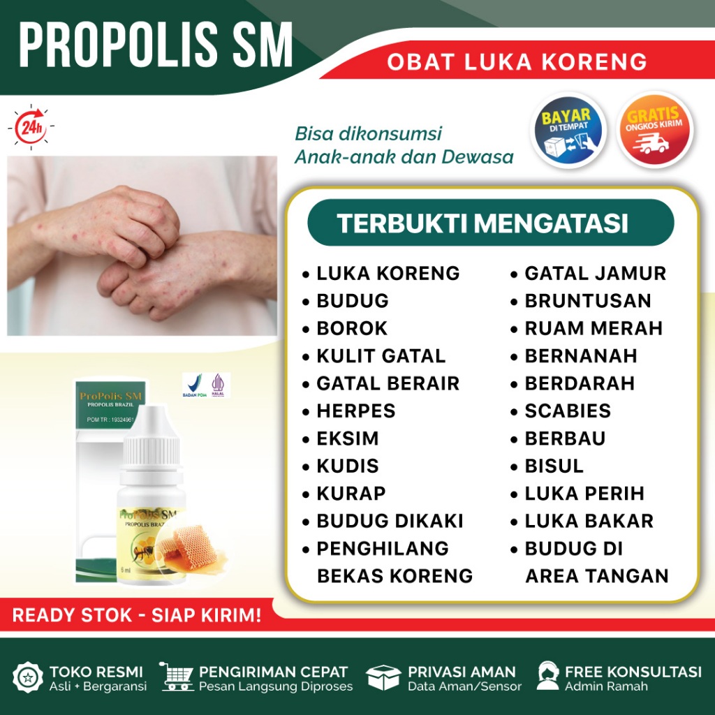 Jual Obat Bekas Koreng, Obat Bekas Korengan, Obat Koreng Di Kaki, Obat ...