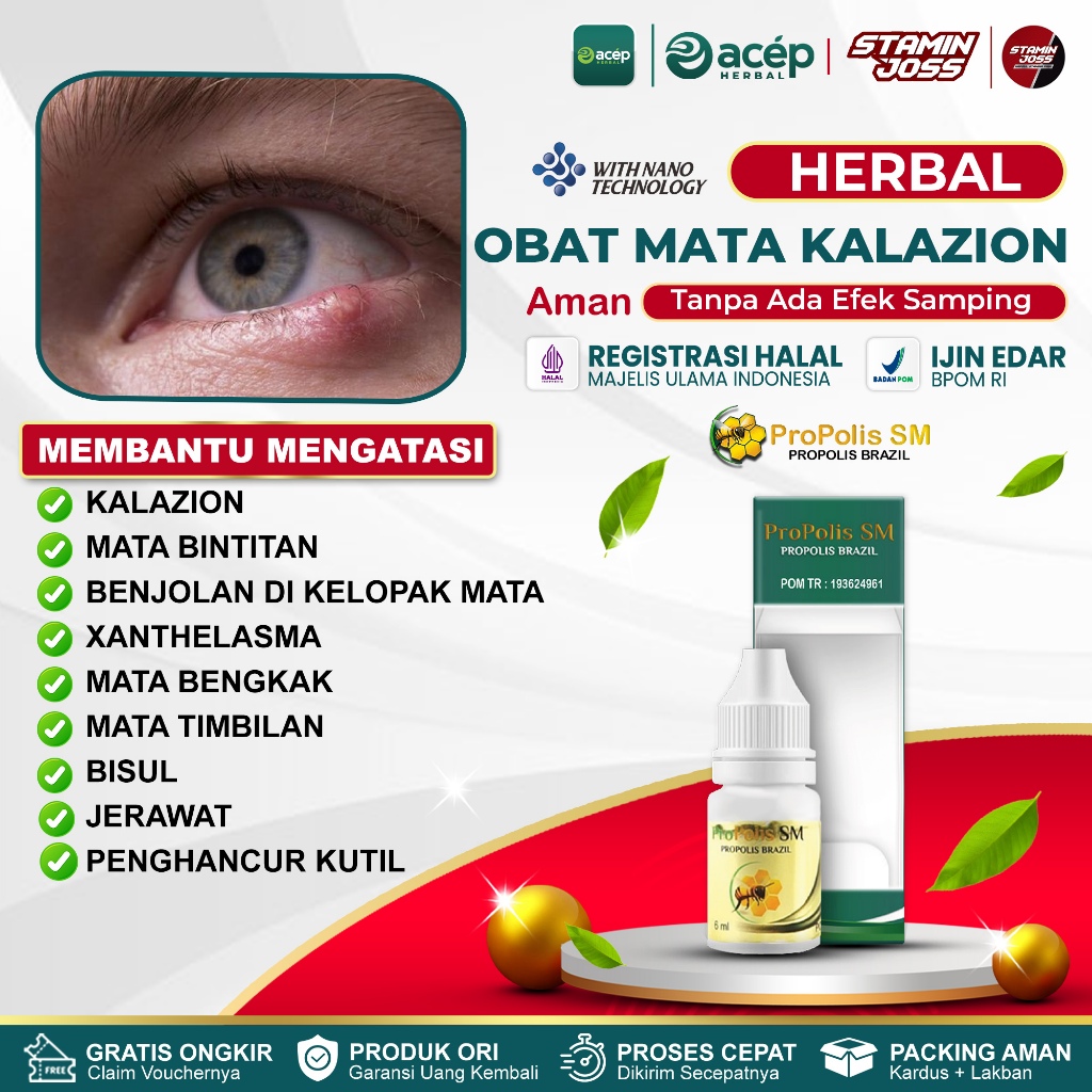 Jual Obat Mata Kalazion Di Kelopak Penghilang Mata Bintitan Timbilan ...
