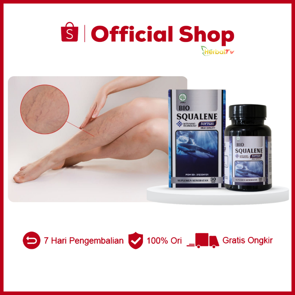 Jual Obat Varises Herbal Varises Di Betis Dan Kaki Otot Kaki Bengkak ...