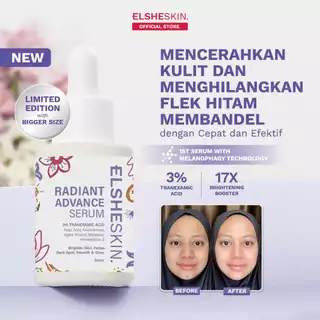 Toko Online ElsheSkin Official Shop | Shopee Indonesia
